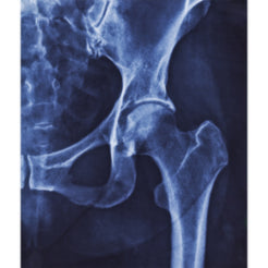 Abrir elemento multimedia 1 en una ventana modal